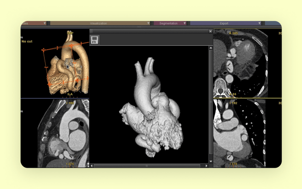 Healthcare Data Visualization: Key Benefits, Challenges, and Tools ...