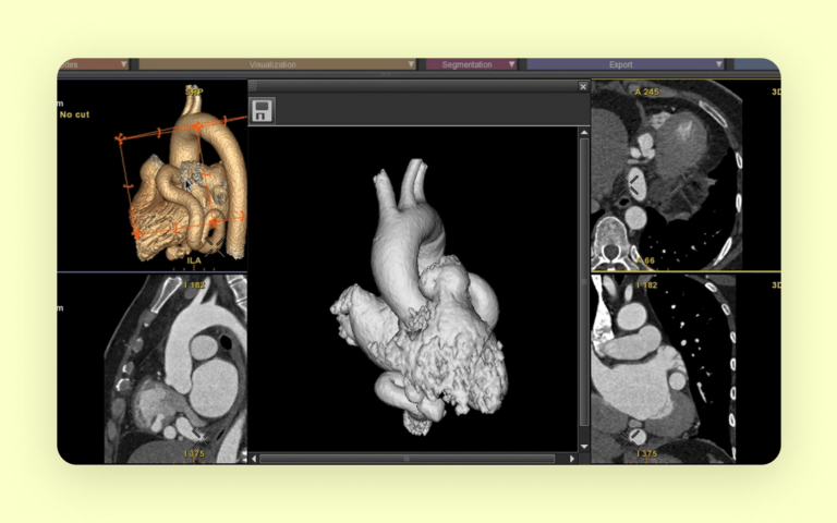 Healthcare Data Visualization: Key Benefits, Challenges, and Tools ...